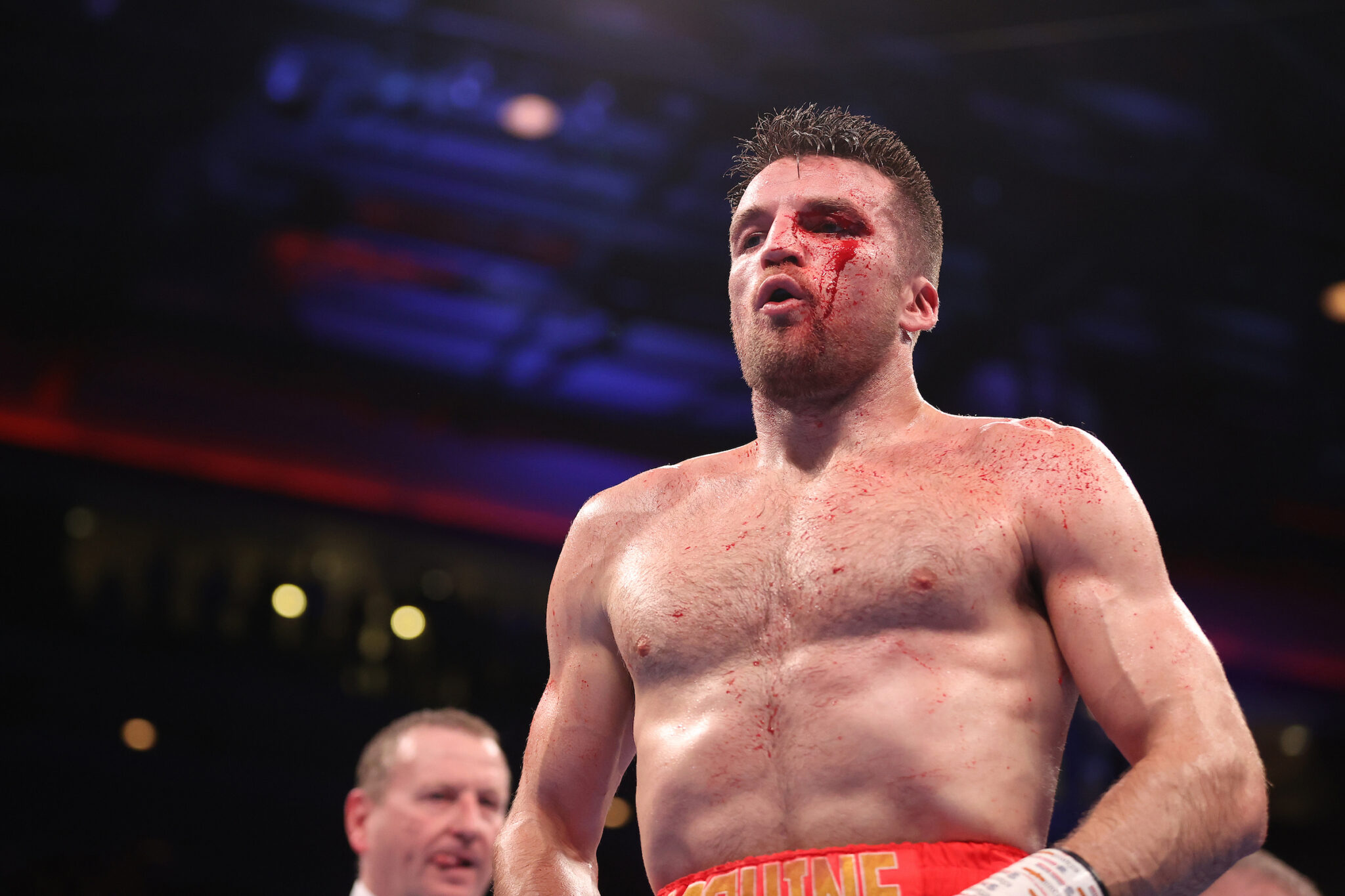 Fowler officially confirms retirement via social media – British Boxing ...